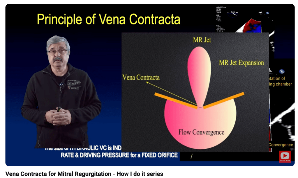 How-I-Do-It Series – Boston Cardiac