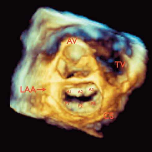 Valve Analysis – Boston Cardiac
